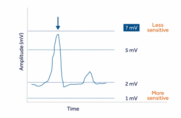임시형 인공심박동기의 적용 - Percutaneous pacemaker, Transvenous temporary ...