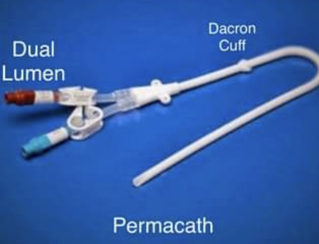 permcath(펌캐스, 터널식카테터)에 관하여 : 네이버 블로그