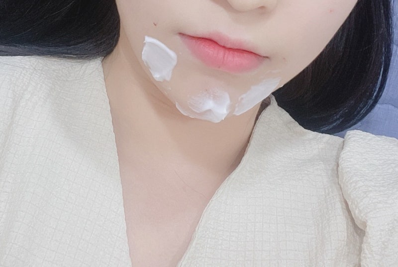 광주 입술필러 입꼬리 필러 입꼬리보톡스 후기 내돈내산 ! (1) : 네이버 블로그