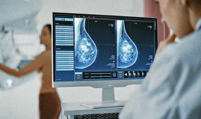 유방 결절 원인 5가지 및 치료 가슴 멍울몽우리 낭종물혹 혹 섬유선종양성종양 유두종 지방종 네이버 블로그