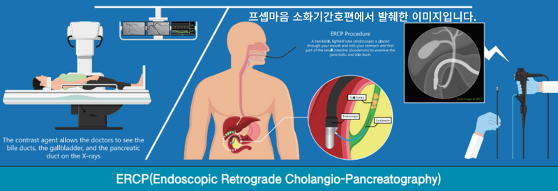 의학용어 ERCP 목적, 방법, 전 후 간호 : 네이버 블로그