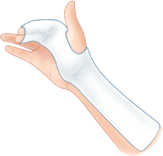 어느 대학병원 간호사의 OS 보조기📝 : 네이버 블로그