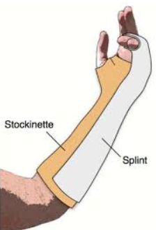 어느 대학병원 간호사의 OS 보조기📝 : 네이버 블로그