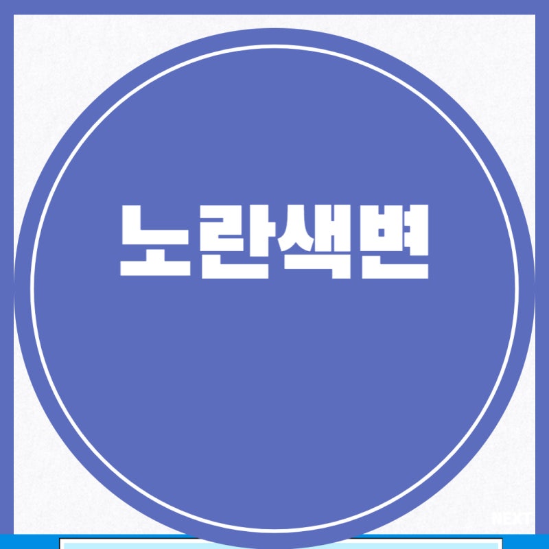 변 색깔 붉은색변 초록색변 혈변 갈색변 검은색변 주황색변 회백색변 노란색변 백색변 똥색깔 대변색깔 네이버 블로그