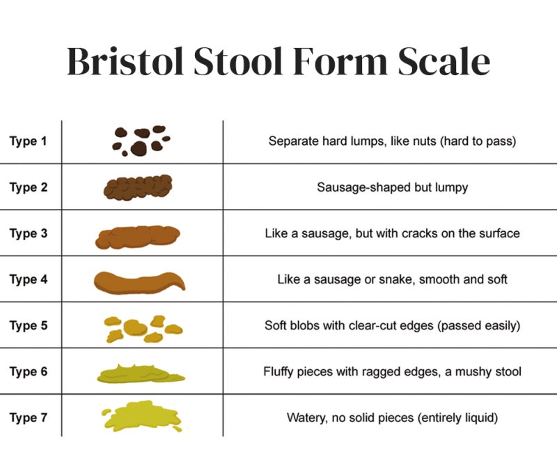 Loose Stool 과 Diarrhea 는 무엇이 다른가? : 네이버 블로그