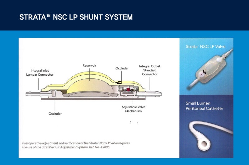 [제품소개]VP Shunt: Strata™ 조절 가능한 압력 밸브 제품군 : 네이버 블로그