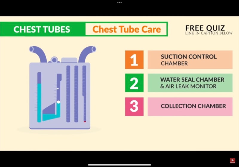 의학용어 CTD (Chest tube drainage for pneumothorax, hemothorax, lobectomy ...