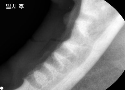 치아흡수성병변 (FORL : Feline Odontoplastic Resorptive Lesion) : 네이버 블로그