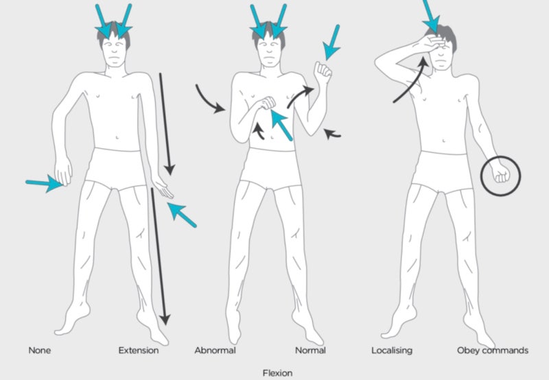 GCS / Limb Motor (사정꿀팁★★) : 네이버 블로그