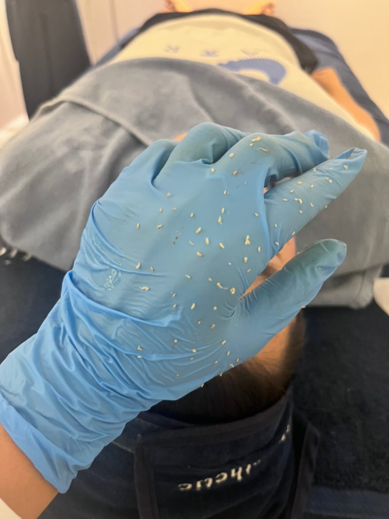 마산여드름 피부과에서 여드름을 제대로 치료하지못하는이유. : 네이버 블로그