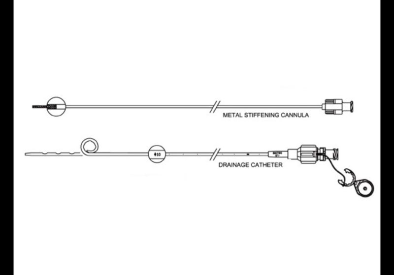 Pigtail catheter - 의학용어 PCD (Percutaneous Catheter drainage) 공부하기 : 네이버 블로그