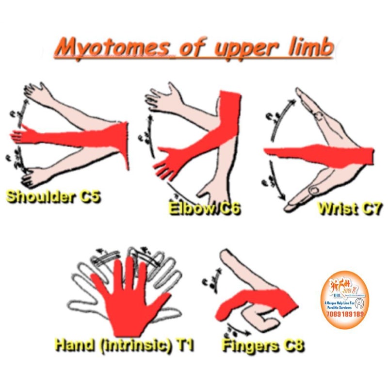 목(상지) - 피부분절 Dermatome, 근육분절 myotome : 네이버 블로그