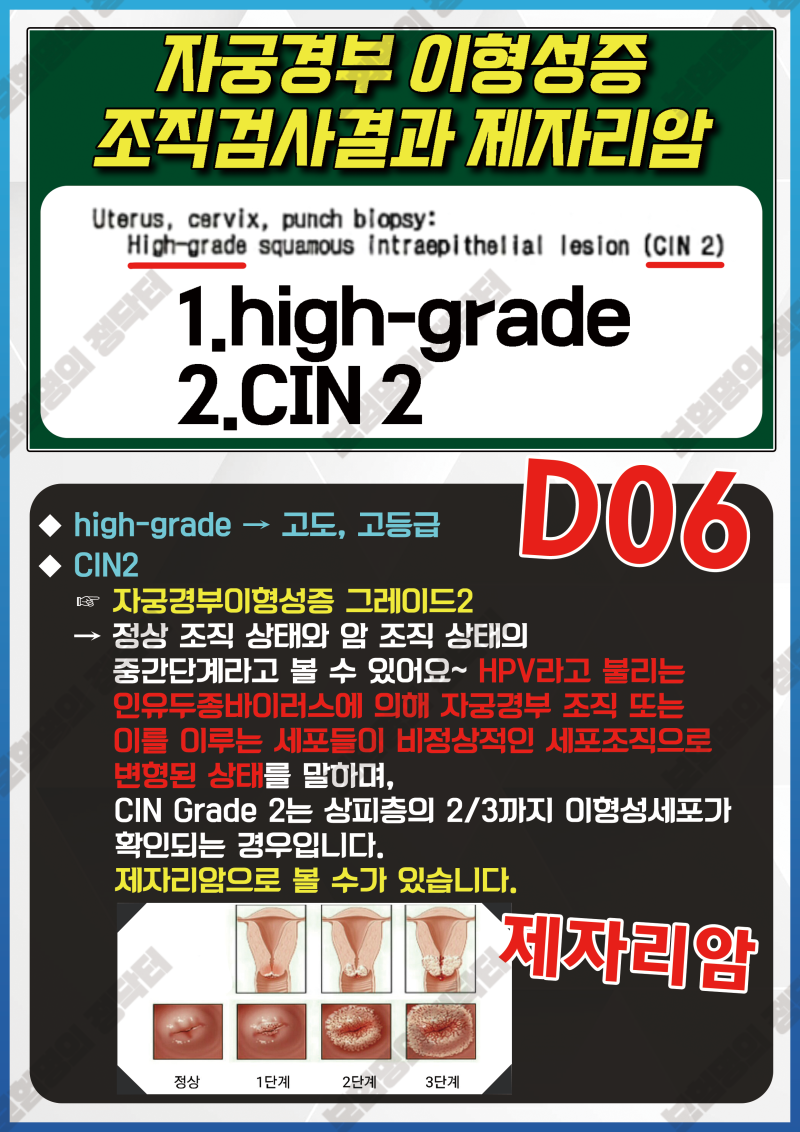 자궁경부이형성증으로 수술하셨나요 질병분류코드가 N87n872이신가요 제자리암d06으로 검토 가능 네이버 블로그