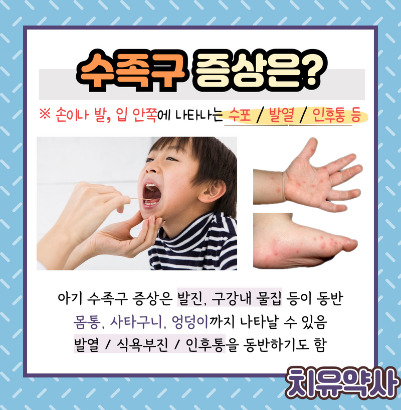 아기 수족구 약사가 알려주는 수족구 증상 전염성 면역력 올려주는 방법 And 수족구에 도움되는 꿀팁 네이버 블로그