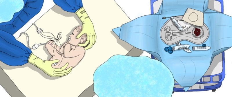 Neonatal sepsis (R/O sepsis ️ sepsis) + spinal tapping / 감염으로부터 아가야들 ...