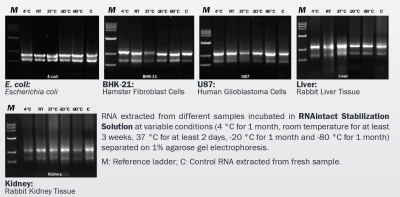 RNAintact Stabilization Solution- 샘플내 RNA를 안전하게 보관 (1+1 프로모션) : 네이버 블로그