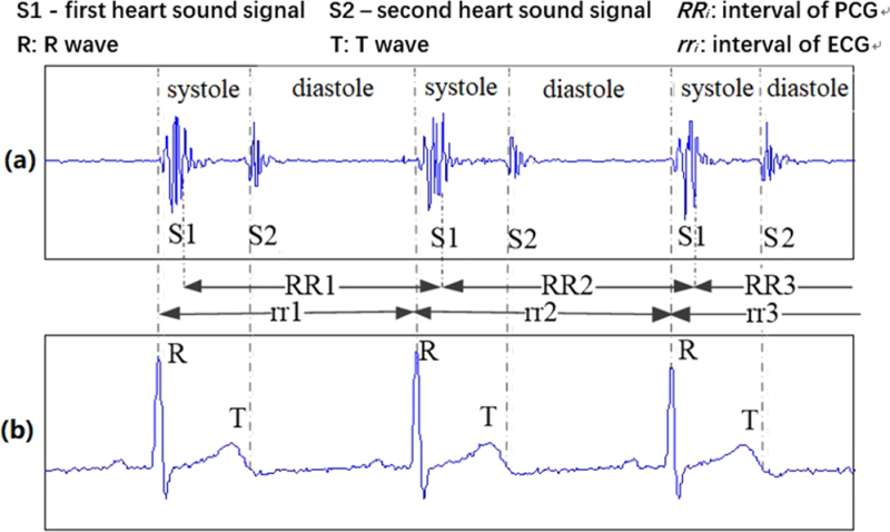 심음(Cardiac sound) : 네이버 블로그
