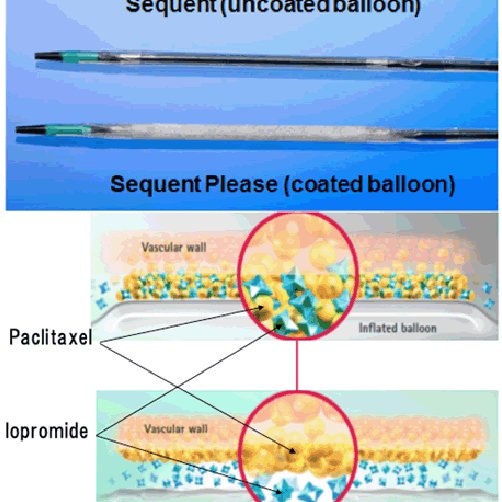 약물방출 풍선카테터(DEB : Drug Eluting Balloon catheter) : 네이버 블로그
