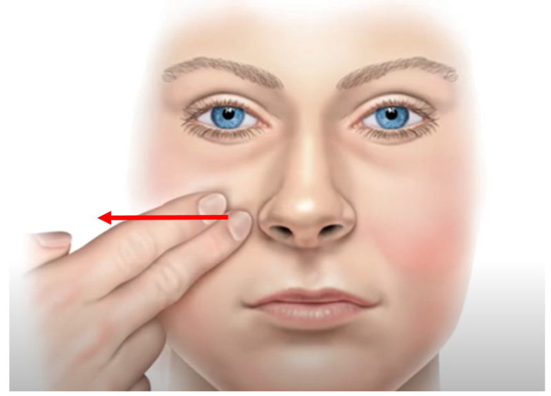 비중격 만곡증(Septal deviation, Deviated nasal septum) (1) - 비중격의 구조, 정의, 원인 ...