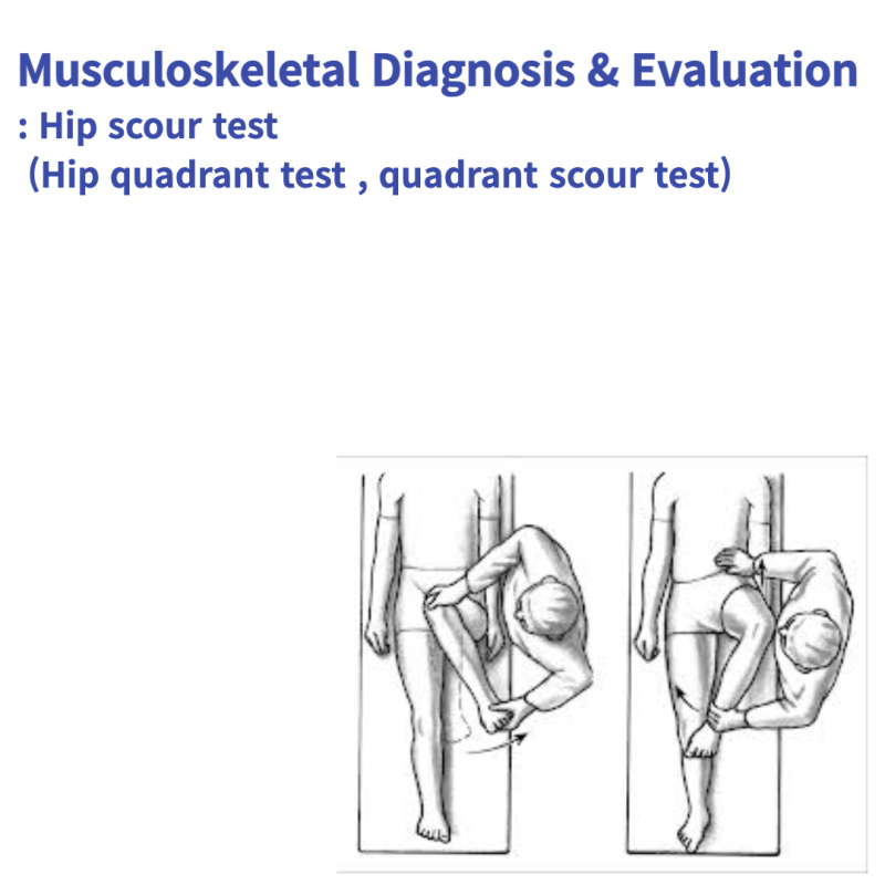 hip quadrant scour test