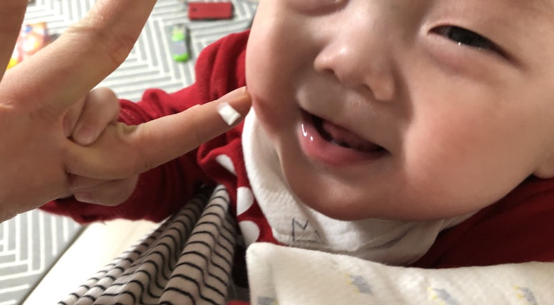 아기동전습진 예민한 아기피부 촉촉하게 네이버 블로그