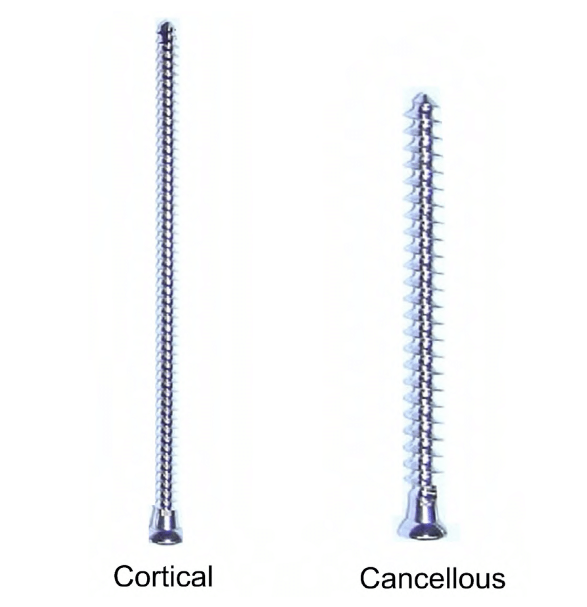 os screw 정리, os 신규, cortical, locking, lag screw, plate : 네이버 블로그