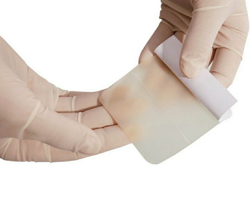 화상입었을 때 메디폼 효과있나요ft교체시기 네이버 블로그