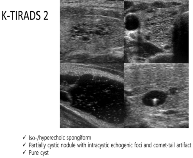 K-TIRADS 2021개정판 총정리 (증례로 보는 갑상선 결절의 최신지견) : 네이버 블로그
