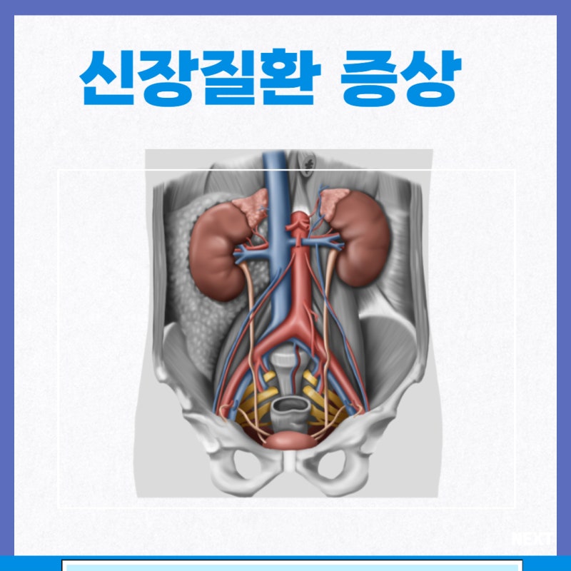 신장질환 증상 사구체신염 신사구체여과율 요독증 복막투석 신장초음파 네이버 블로그