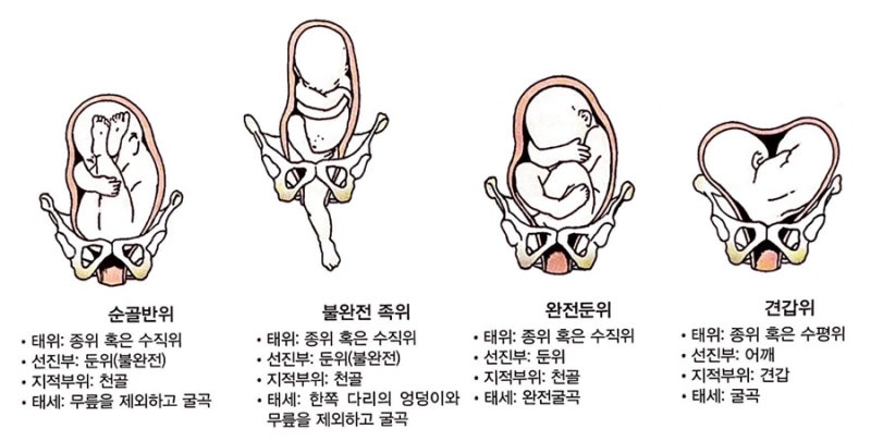 여성간호학 분만기 여성 분만 생리 대횡경선소사경선대사경선태위두위둔위견갑위대각결합선진결합선견축륜자궁수축