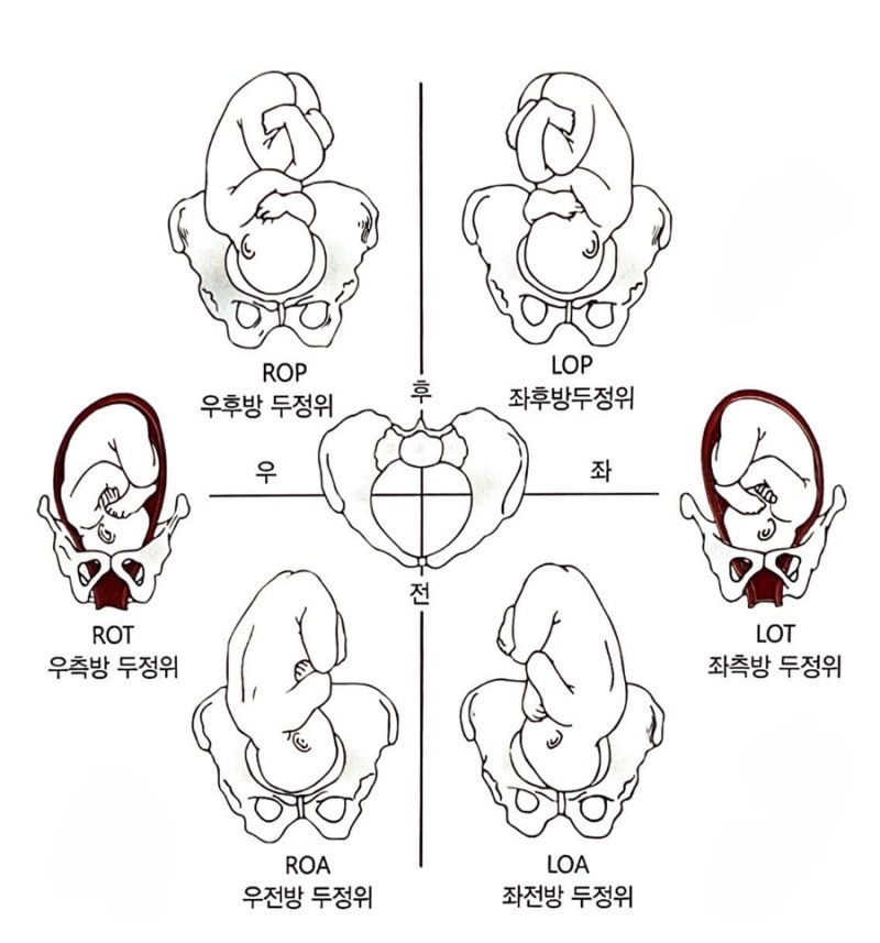 여성간호학 분만기 여성 분만 생리 대횡경선소사경선대사경선태위두위둔위견갑위대각결합선진결합선견축륜자궁수축
