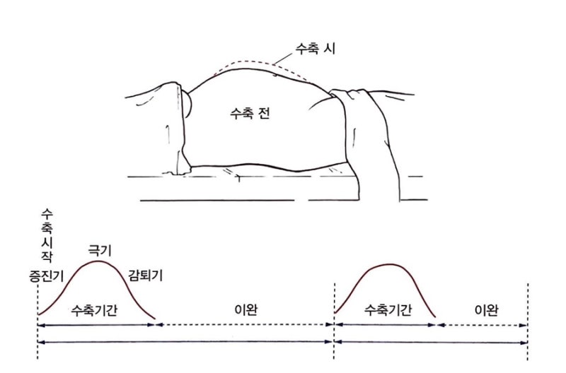 여성간호학 분만기 여성 분만 간호 분만통증레오폴드촉진법질내진파막검사나이트라진태아곤란증라마즈호흡법힘주기회음