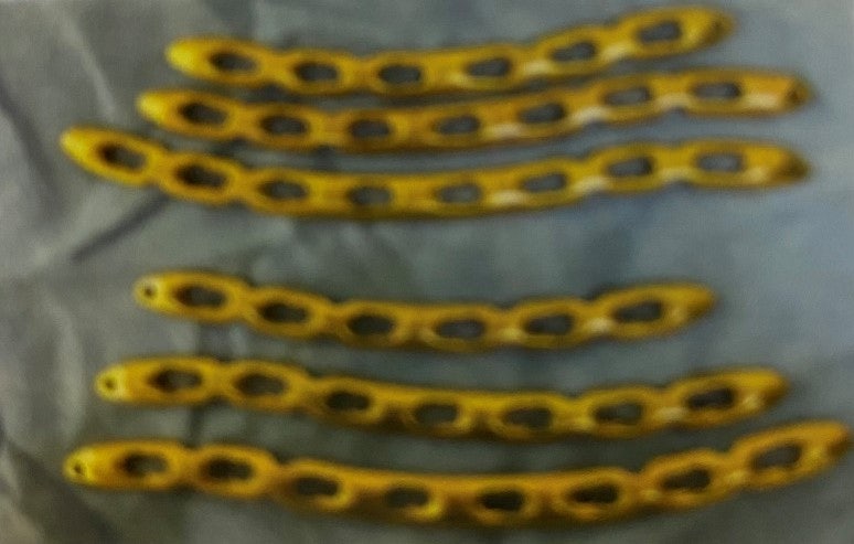 os신규,plate종류,lcp,rcp,dcp,anatomical plate : 네이버 블로그