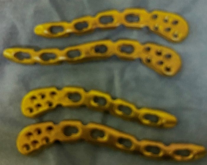 os신규,plate종류,lcp,rcp,dcp,anatomical plate : 네이버 블로그