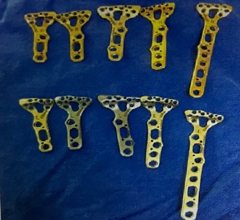 os신규,plate종류,lcp,rcp,dcp,anatomical plate : 네이버 블로그