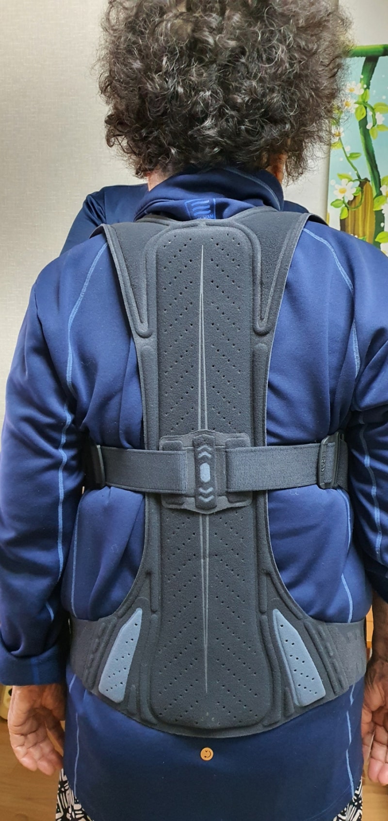 척추압박골절과 골시멘트 시술 비용 네이버 블로그