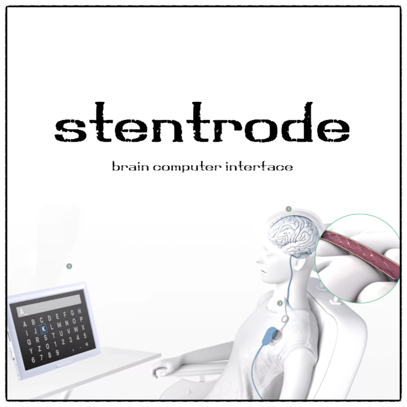 싱크론에서 개발한 '스텐트로드(stentrode)' FDA 승인 :: 목 경정맥에 심는 BCI 장치 : 네이버 블로그