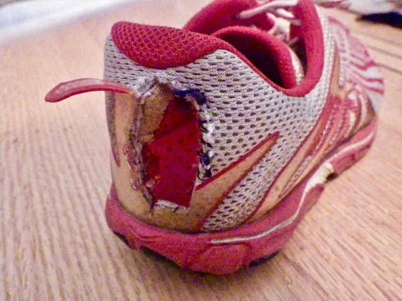 Haglund씨 변형으로 인한 수술과 재활운동 : 네이버 블로그