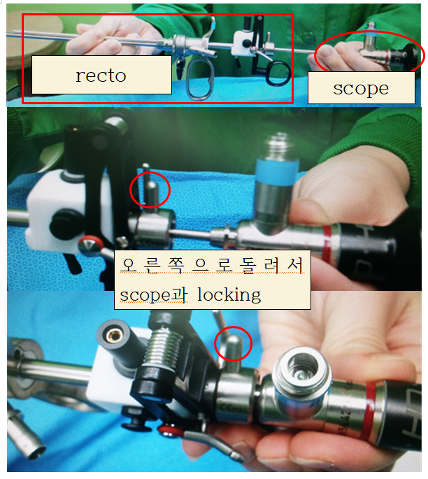수술실 신규간호사를 위한 GY수술 알아보기- Hystero-resecto-scopy : 네이버 블로그