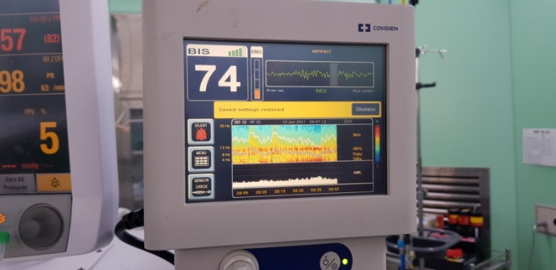 마취심도 모니터링 (BIS /ENTROPY/마시모 SEDLINE) +TOF : 네이버 블로그