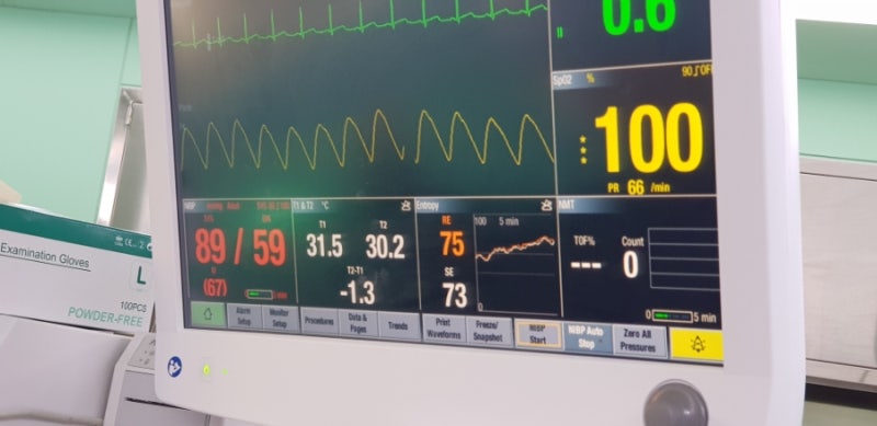 마취심도 모니터링 (BIS /ENTROPY/마시모 SEDLINE) +TOF : 네이버 블로그