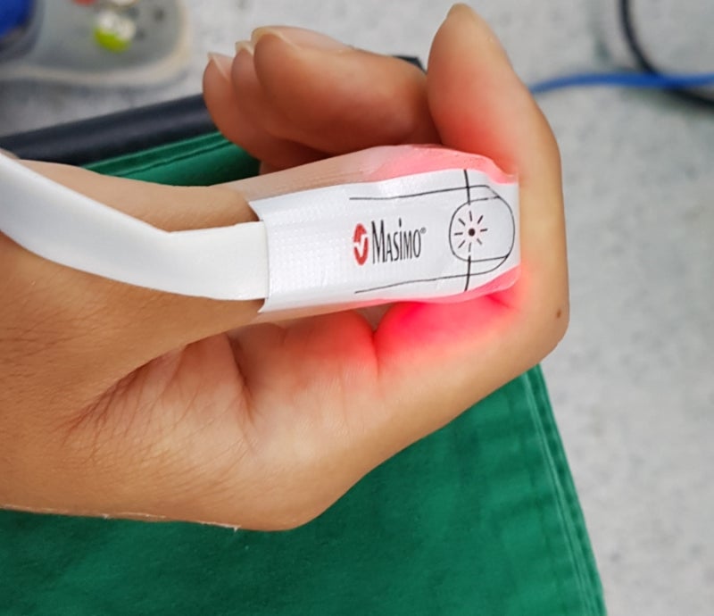 마취심도 모니터링 (BIS /ENTROPY/마시모 SEDLINE) +TOF : 네이버 블로그