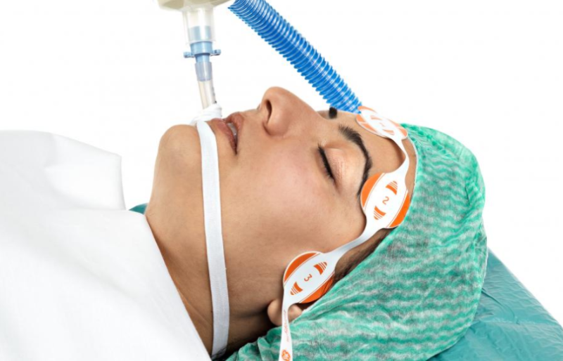 마취심도 모니터링 (BIS /ENTROPY/마시모 SEDLINE) +TOF : 네이버 블로그