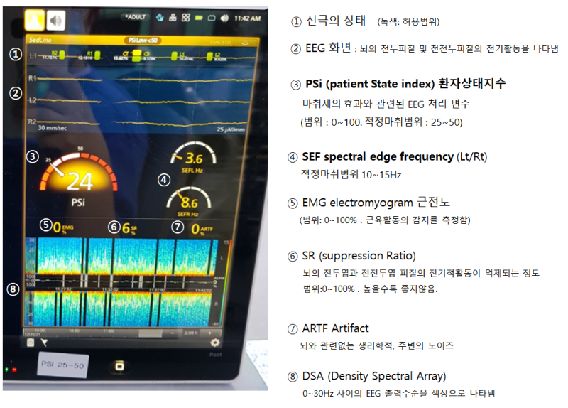 마취심도 모니터링 (BIS /ENTROPY/마시모 SEDLINE) +TOF : 네이버 블로그
