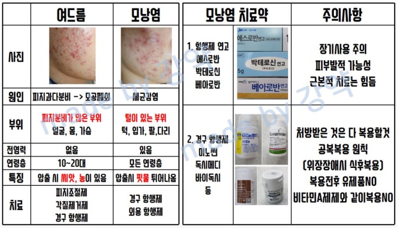 모낭염 치료 여드름과 차이 미노씬캡슐에스로반베아로반박테로신 효과 부작용 네이버 블로그
