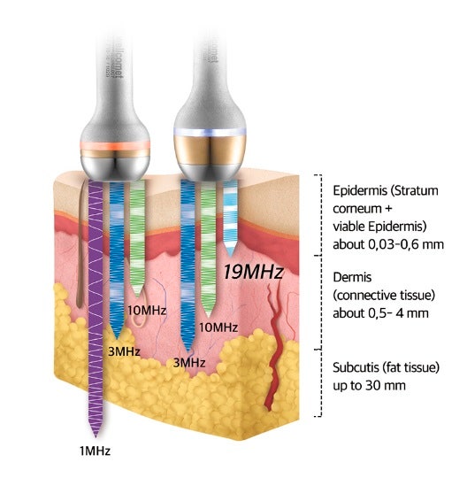 LDM 피부 관리 효과와 관리 초음파 장비의 차이점? : 네이버 블로그