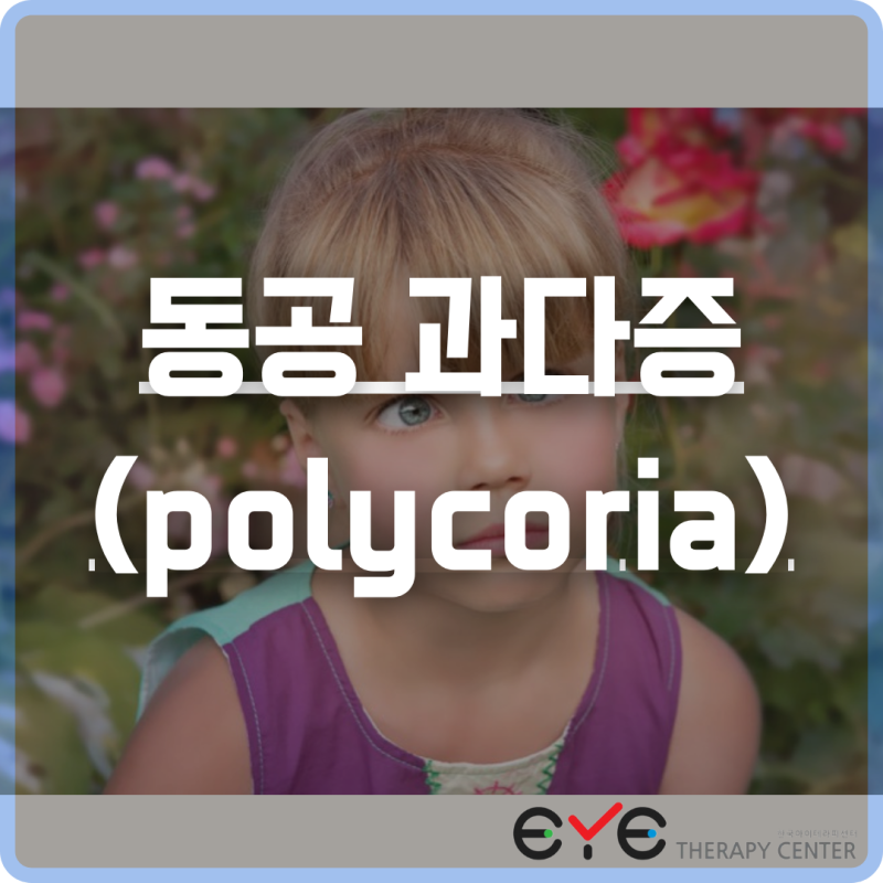 동공 과다증(다동공증) polycoria 이란? : 네이버 블로그