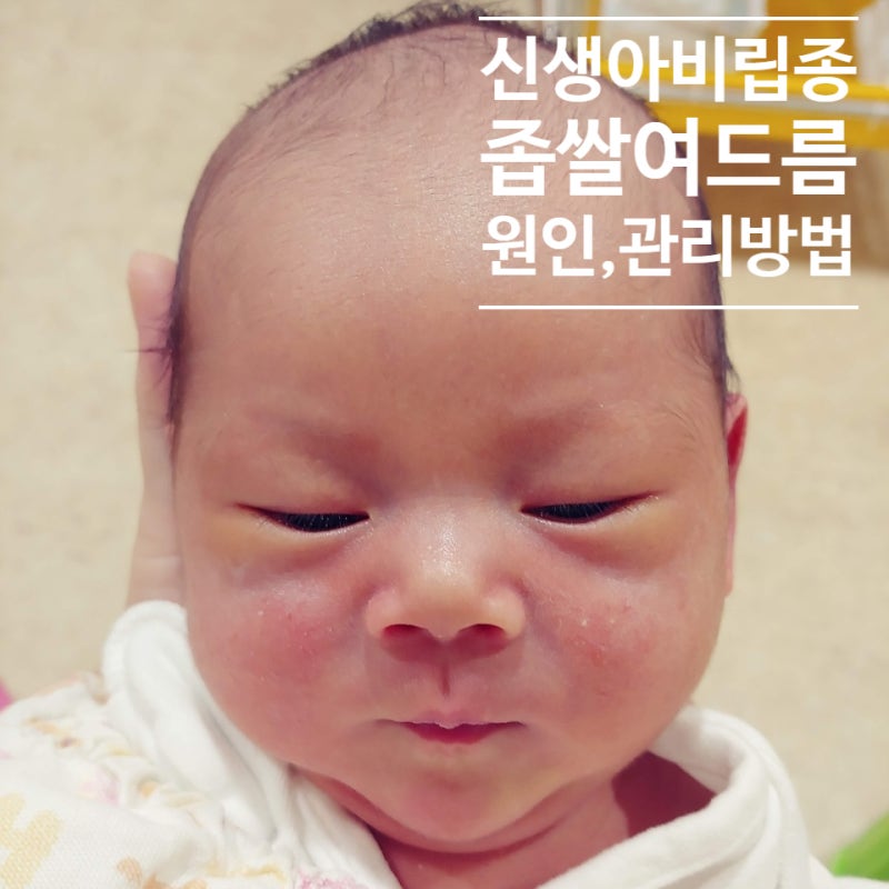 신생아 비립종과 좁쌀여드름 원인과 관리방법 잘못하면 흉터가 남아요 네이버 블로그