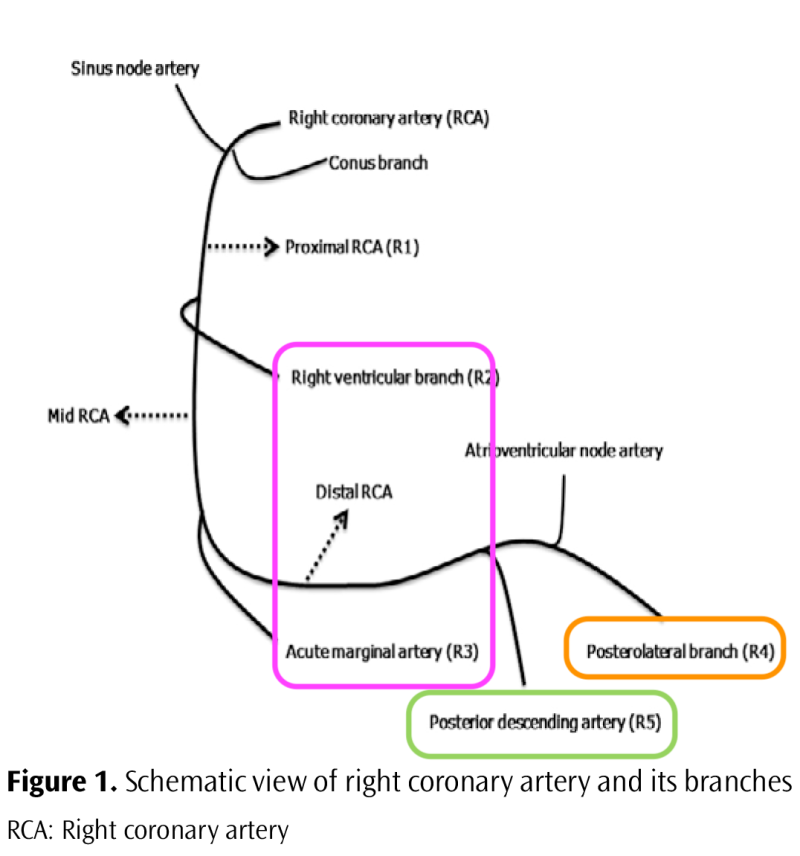 LAD, LCX, RCA 구분하는 법 ; coronary angiograpy 보는 법 : 네이버 블로그