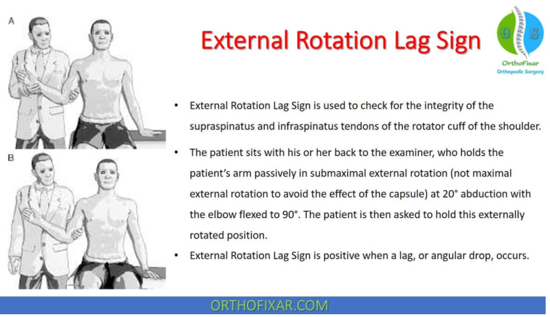 어깨의 문제로만 봐야하는가? 어깨 통증 평가 (회전근개파열, 충돌증후군(rotator cuff syndrome ...